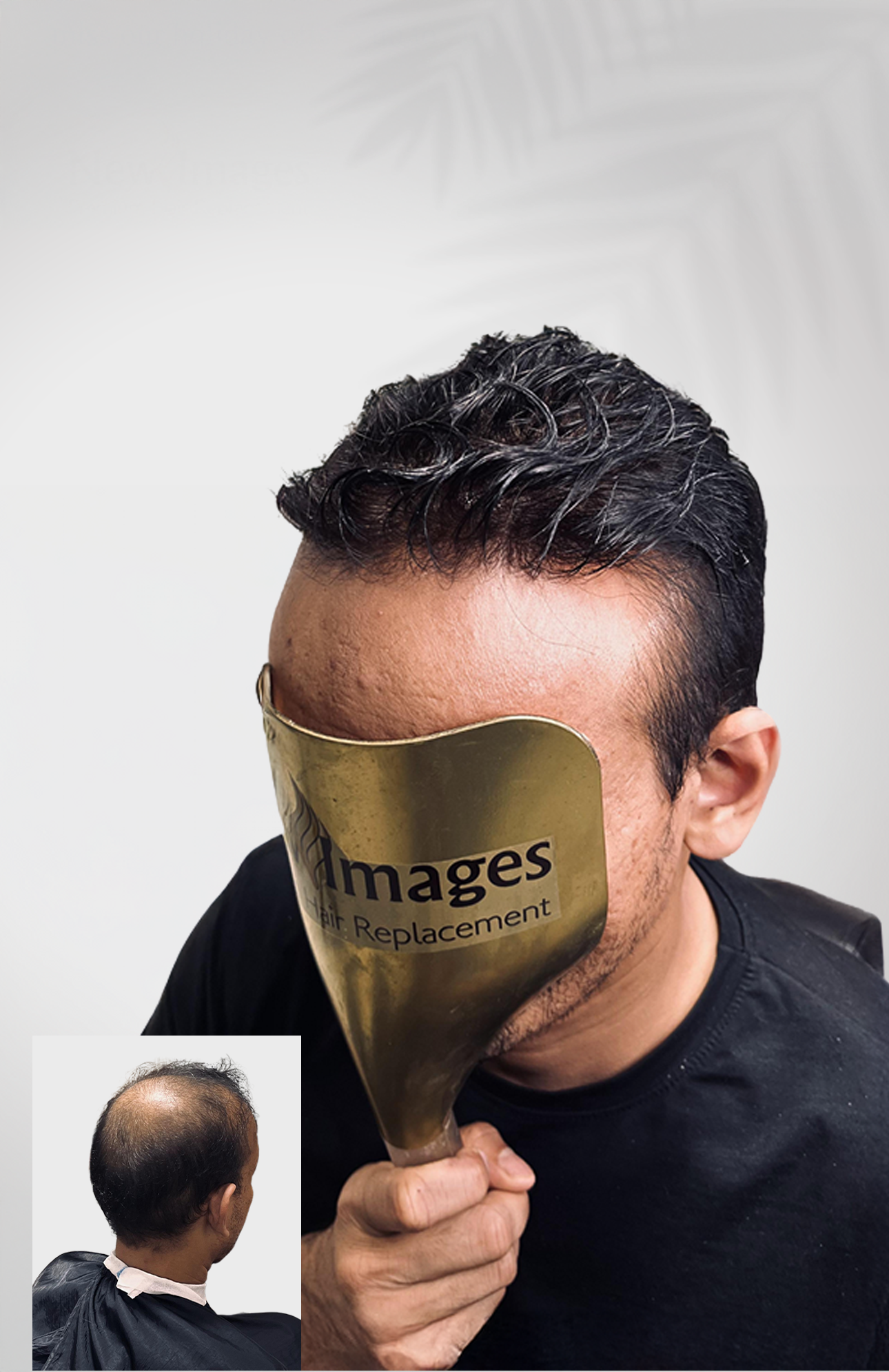 New Images Hair Replacement Center